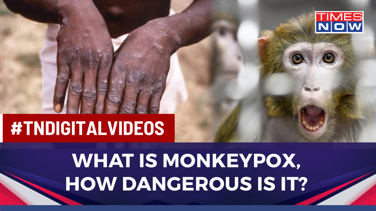 All About Monkeypox, How Dangerous Is Smallpox-Like Disease From Africa ...