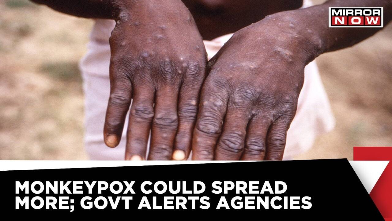 Monkeypox Outrage | Government Alerts NCDC, ICMR To Close Watch | World ...
