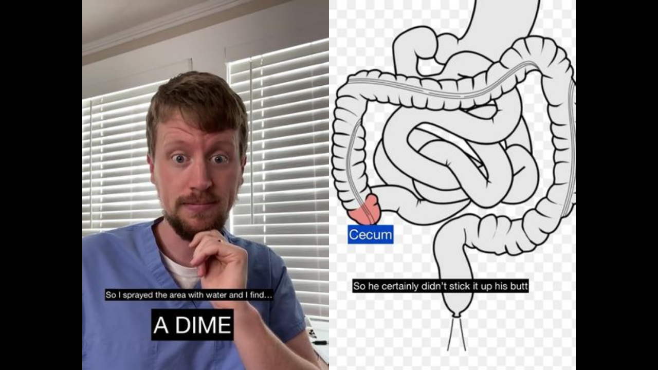 Doctor shocked to find mystery coin in THIS part of patient's body ...