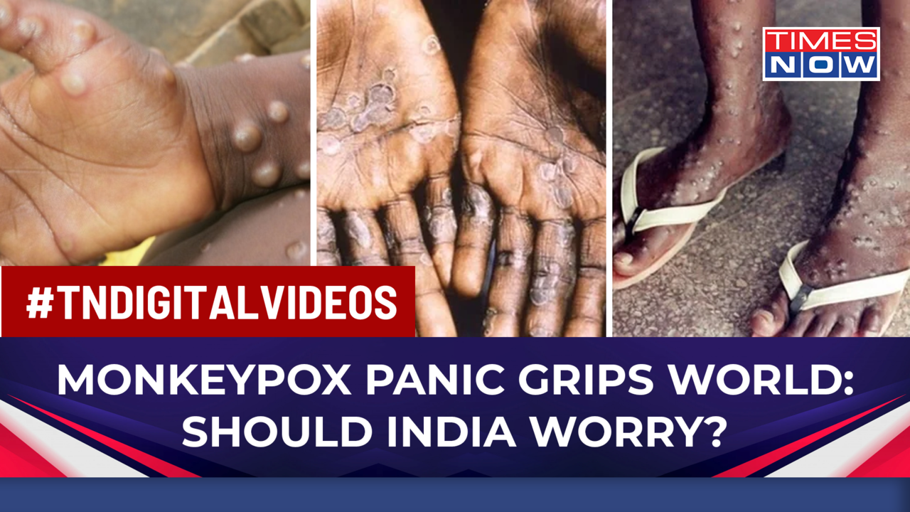 Monkeypox Outbreak: India Puts Precautionary Measures In Place As Cases ...