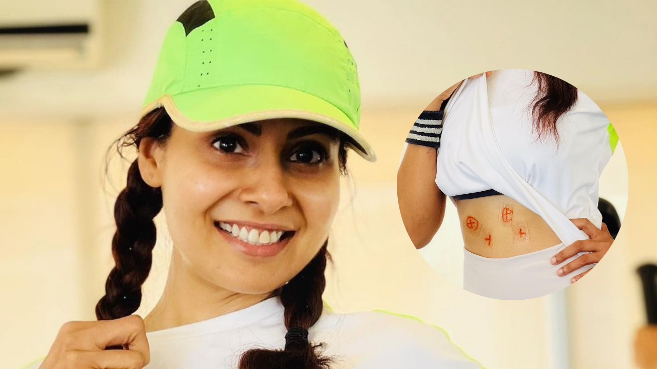 Cancer survivor Chhavi Mittal undergoes radiotherapy, shares photo of ...