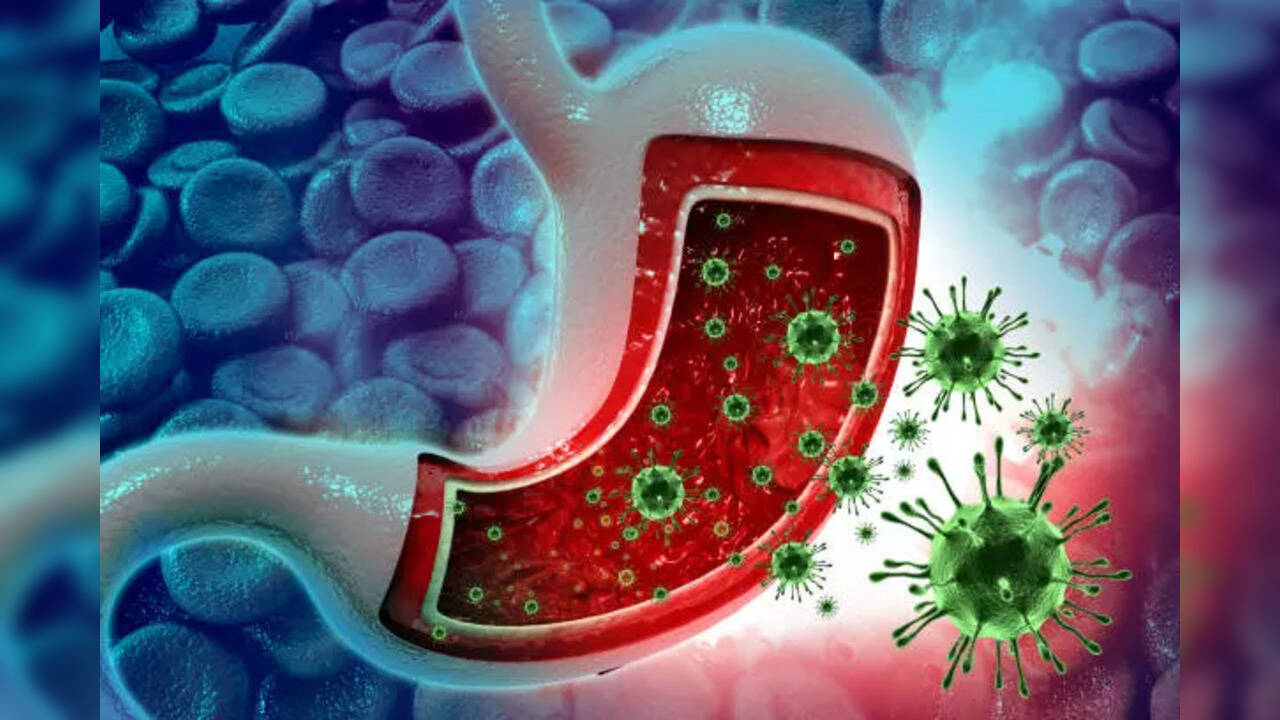 Norovirus confirmed in Kerala: What is this highly contagious disease ...