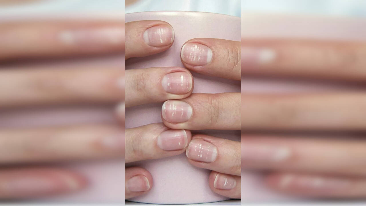 6 fingernail signs you must NEVER ignore