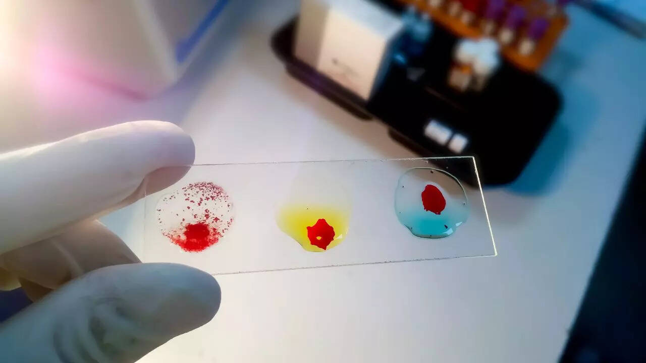 Gujarat man found with unique blood group; first in India and 10th in ...