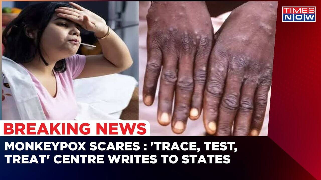 Monkeypox Horror : Centre Writes To States, 'Don't Let Guard Down ...