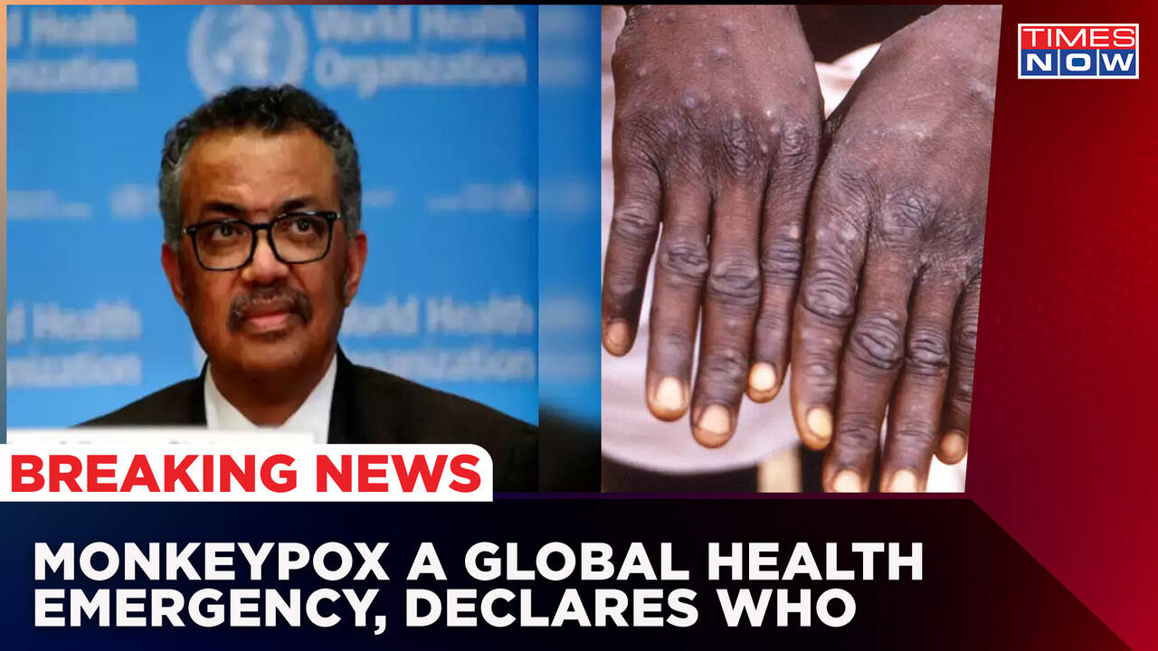 WHO Declares Monkeypox A Global Health Emergency, Sounds Alert | Times ...