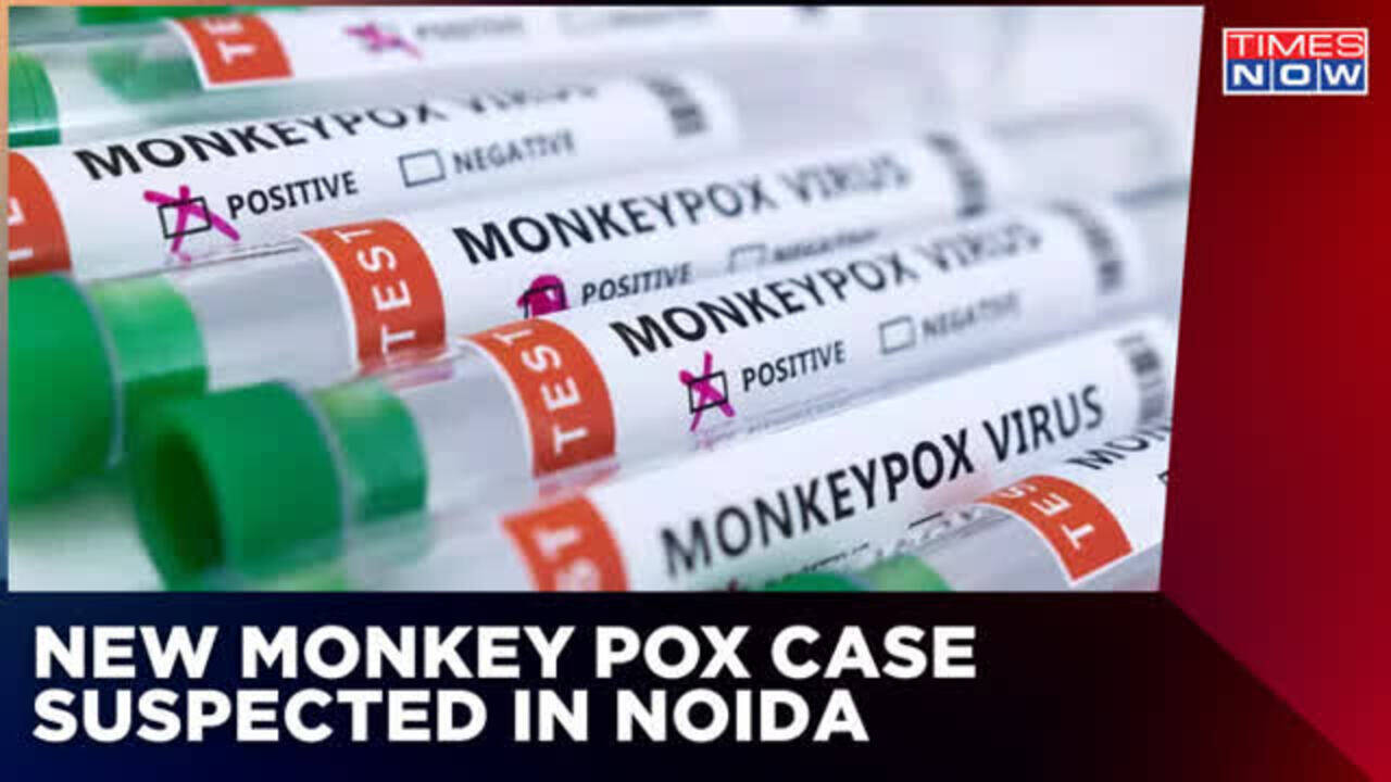 Monkey Pox scare in the National capital; sample taken for further ...
