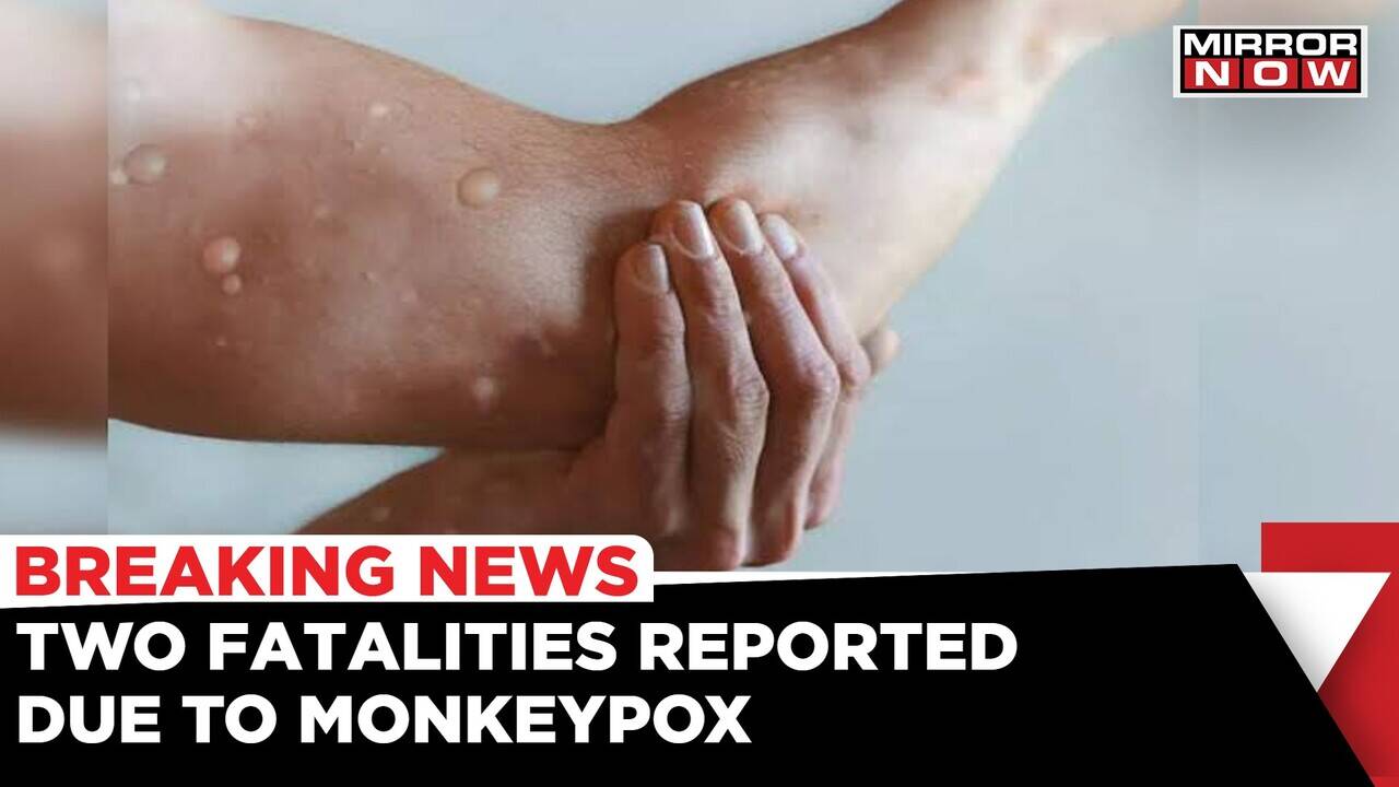 Monkeypox Scare | Two Deaths Reported In Spain And Brazil | Latest News ...