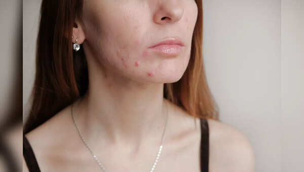 Sleeping with makeup is the WORST thing, know how it damages your skin ...