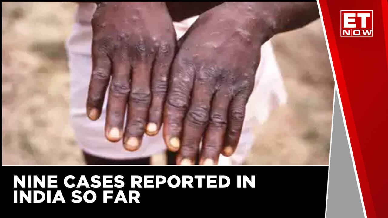 ET Now Explains: All You Need To Know About Monkeypox | India Tonight ...