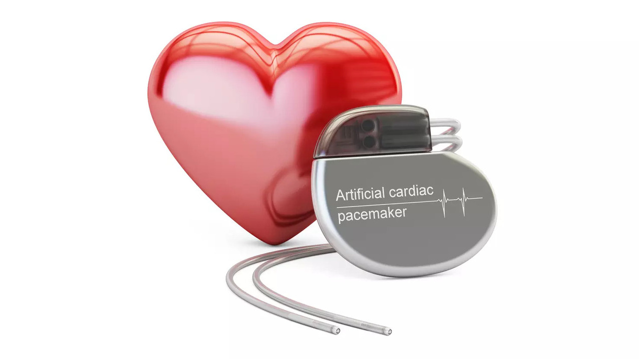 Signs that your pacemaker could be malfunctioning, steps to prevent a ...