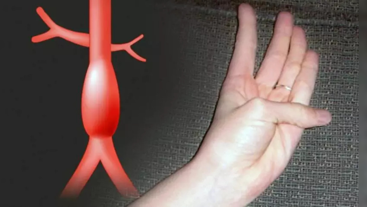 Learn how to check your risk of diseases with a simple thumb palm test ...