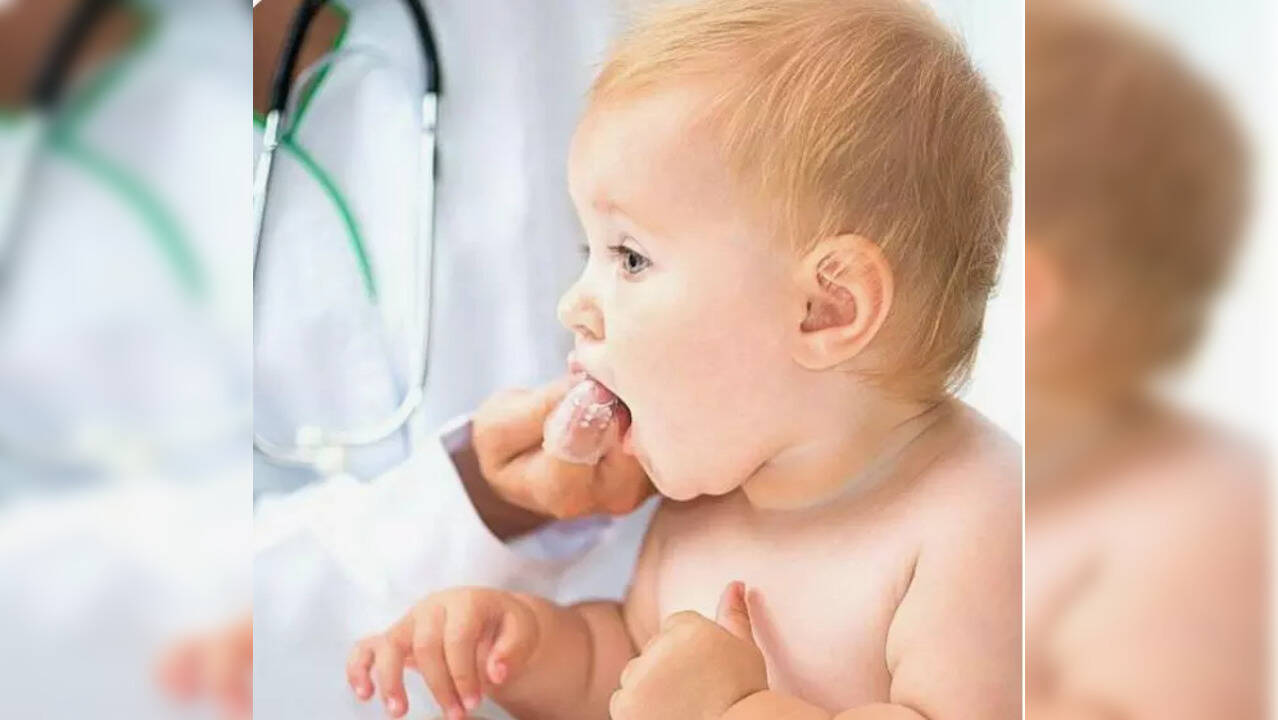 Baby swallows nail-cutter; doctor and team work a miracle rescue ...