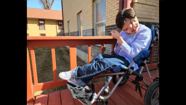 'Miracle' boy born with 'two faces' defies odds to celebrate 18th ...