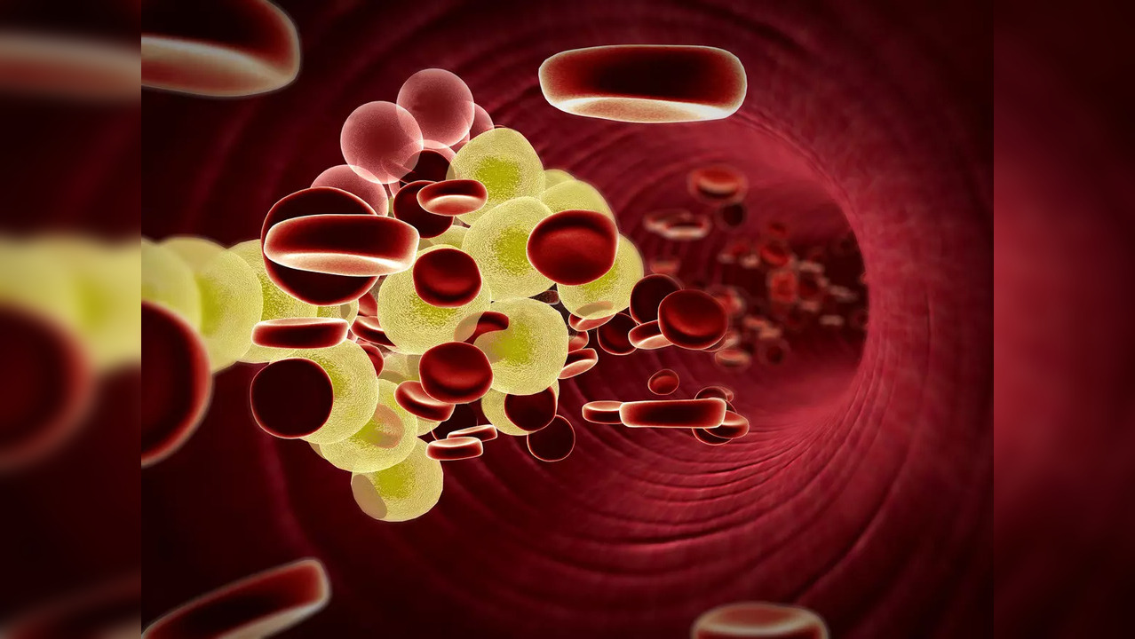 Revealed! Try these time-tested tricks to control cholesterol post 50 ...