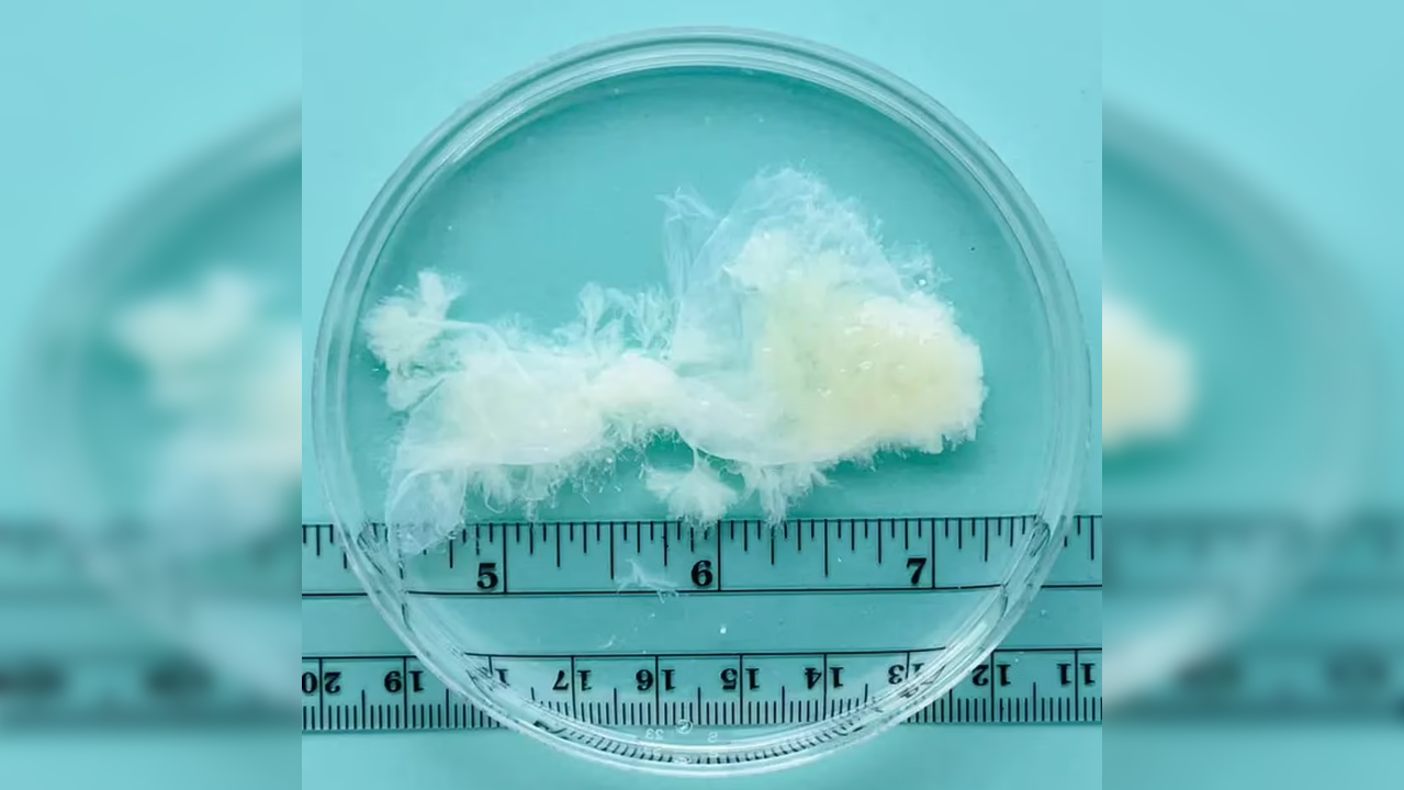 Photos showing what early abortions actually look like go viral; leave ...