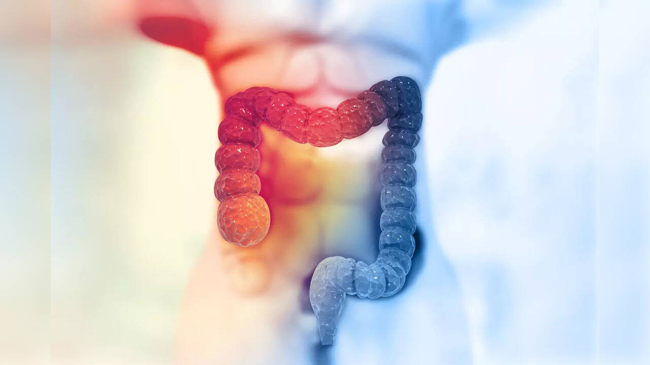 Colorectal Cancer: Stages, signs and symptoms, types, and treatment ...