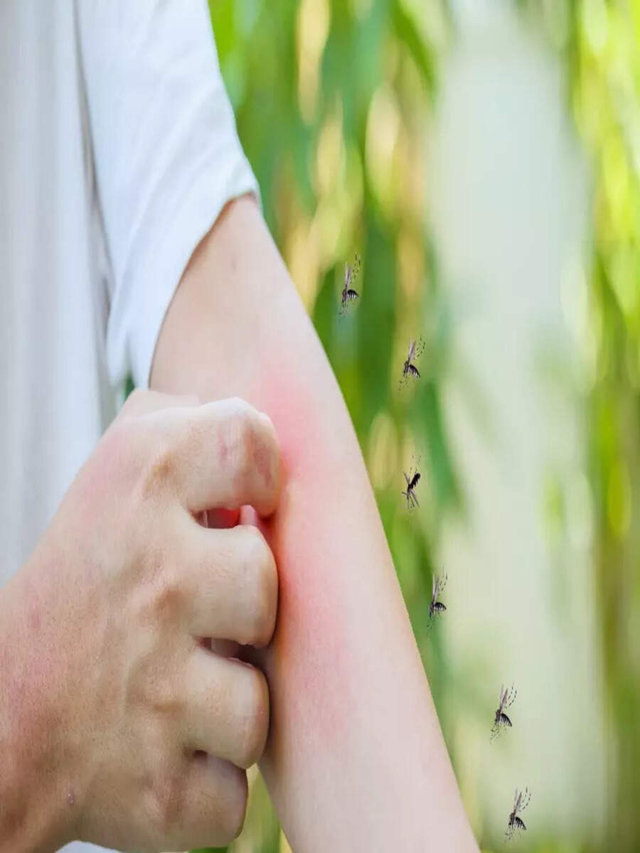 Rise in Dengue cases: Here’s all you need to know about the mosquito-borne disease| Times Now