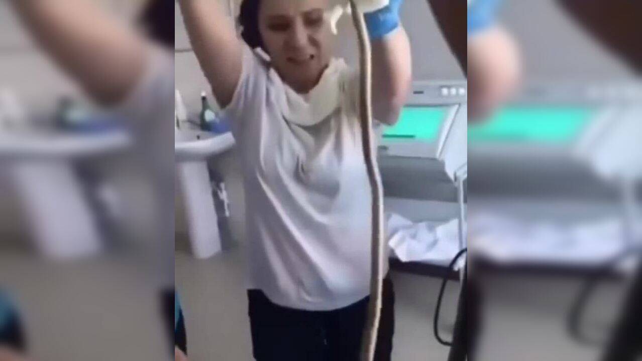 Doctors pull snake out of woman| Viral video: Doctors pull out 4-foot ...