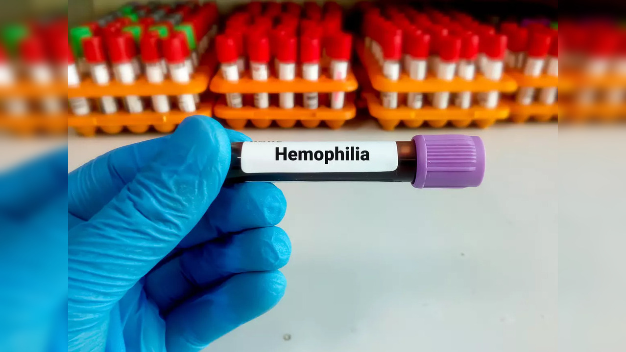 Hemophilia drug is the world's most expensive at $3.5 million per dose ...