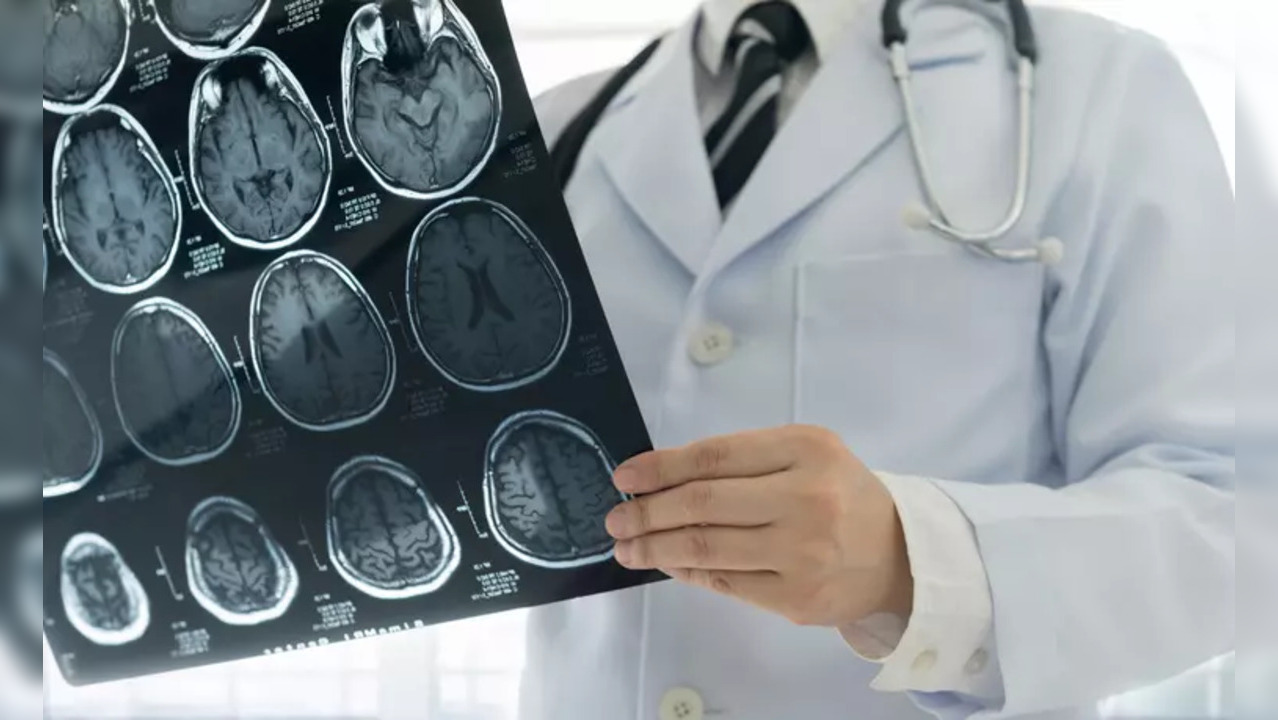 Shocking! Brain scans reveal how migraines affect the master organ ...