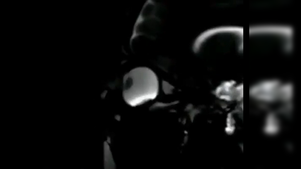 What really happens inside when you rub your eyes? MRI scan video ...