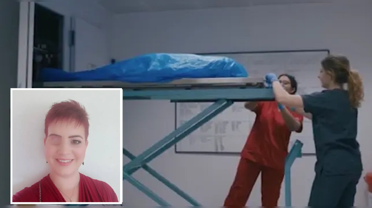 'I'd love for people to learn from my illness': In a first, woman's ...