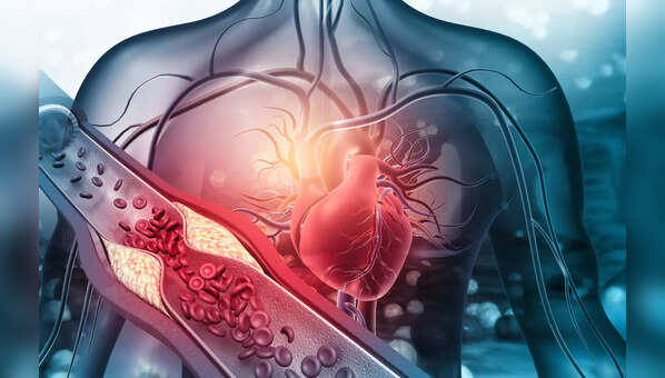 Signs you have blood clots in your arteries; act fast before they cause ...