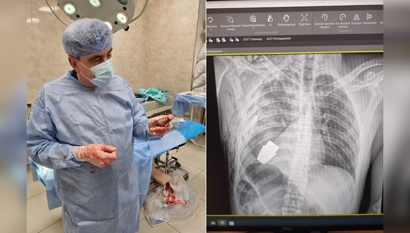 Fearless surgeon removes live grenade that could've explode inside ...