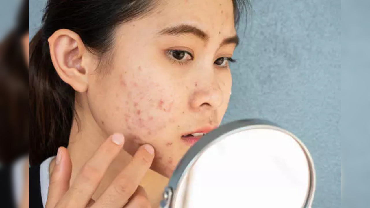 Notice zits or waxy lumps on your face? Beware as it could be a warning ...
