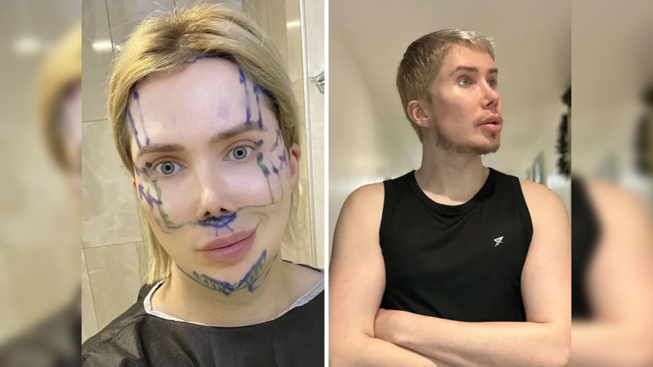 Man spends Rs 2.5 crores to look Korean, transitions back to a British ...