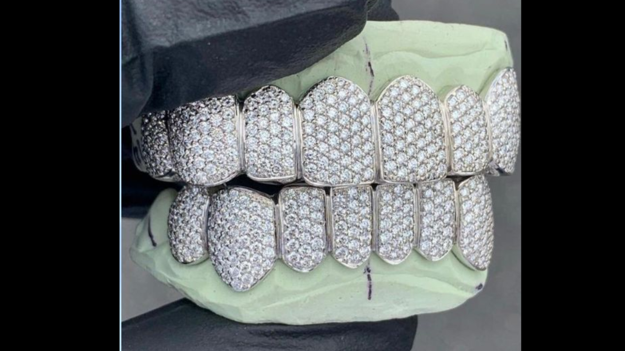 Dentures Are Forever: Surat Jewellers Sell 'Diamond Teeth' For Rs 40 ...