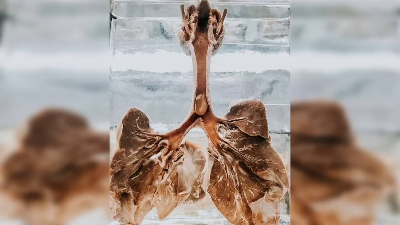 What Does Choking Look Like? Checkout This SHOCKING Image | Health News ...